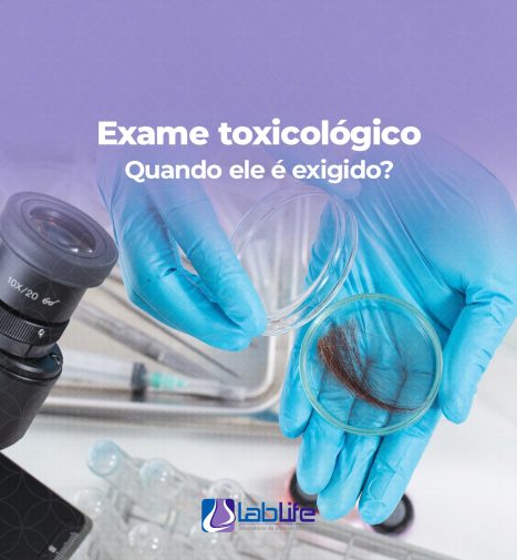 Exame Toxicologico para Detran – Lablife
